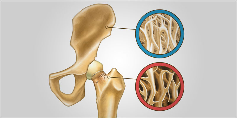 Bones – The CBD Believer