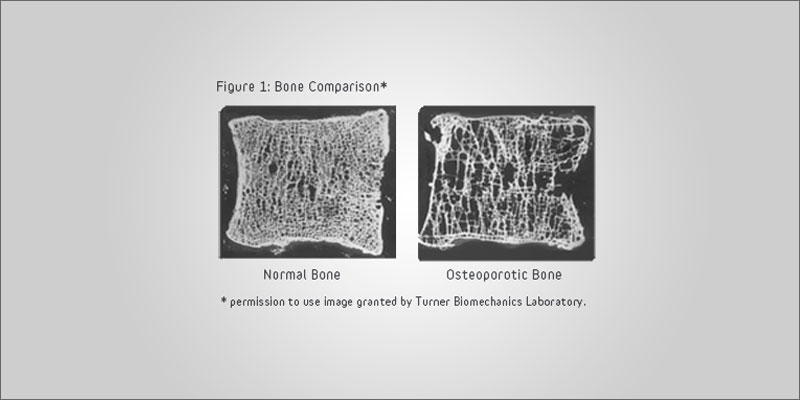 Bones – The CBD Believer