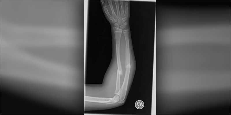 Bones – The CBD Believer