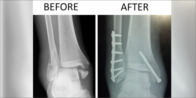 Bones – The CBD Believer